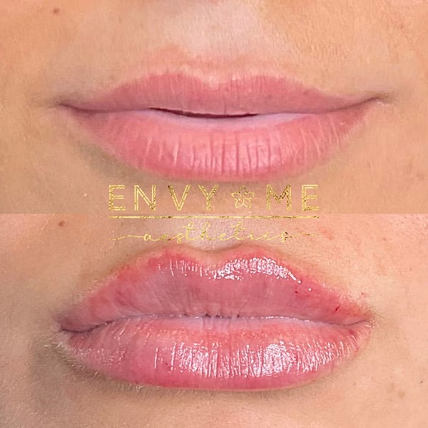 Envy Me Aesthetics Med Spa | Nonsurgical Facial Aesthetics with ...